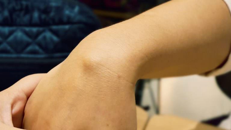 Yağ Bezesi İçin Hangi Doktora Gidilir?